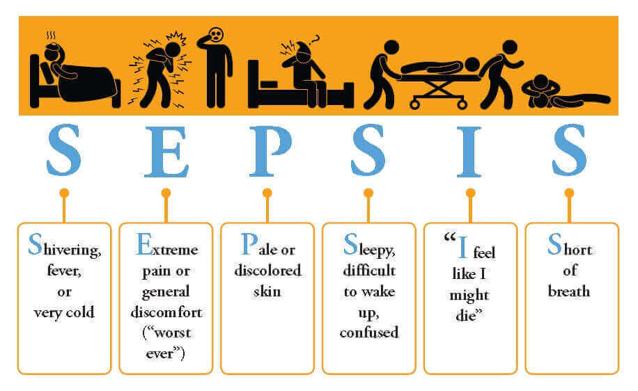 Sepsis Septicemia Symptoms Causes Treatment Health Blog